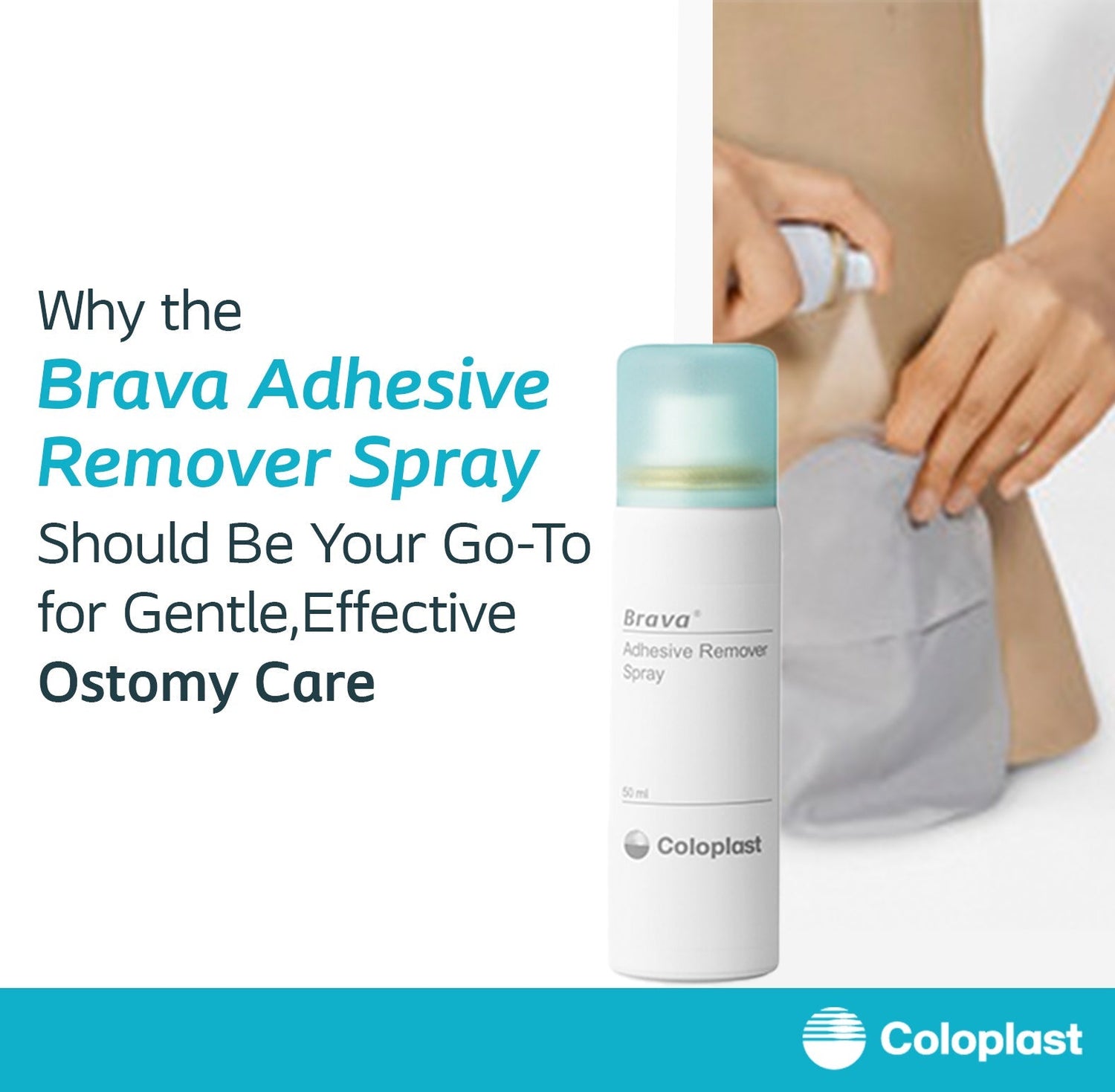 Brava Adhesive Remover Spray by Coloplast-The Go-To Choice for Ostomy Care